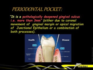 Periodontal pockets & it's pathogenesis | PPTX