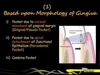 Periodontal pockets & it's pathogenesis | PPTX