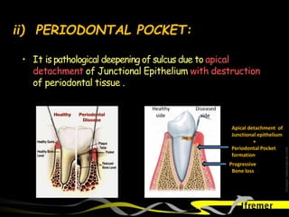 Periodontal pockets & it's pathogenesis | PPTX