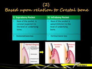 Periodontal pockets & it's pathogenesis | PPTX