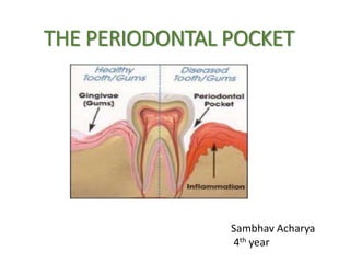The Periodontal Pocket | PPTX