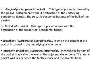The Periodontal Pocket | PPT