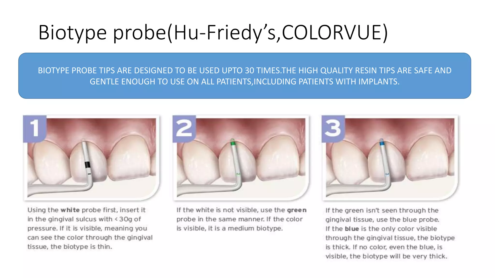 Periodontal probe | PPTX