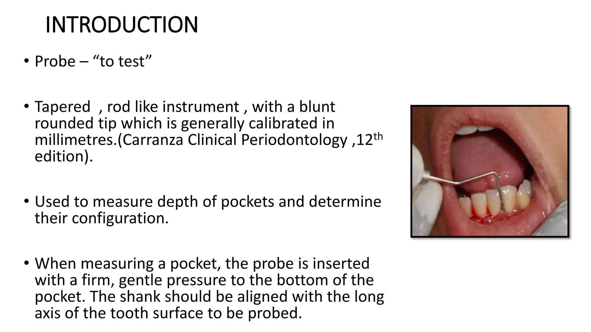 Periodontal probe | PPTX