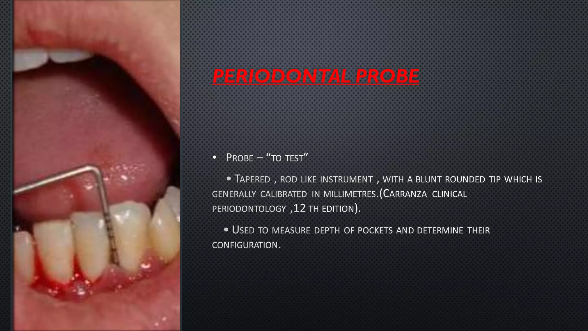 Periodontal probe and explorer | PDF
