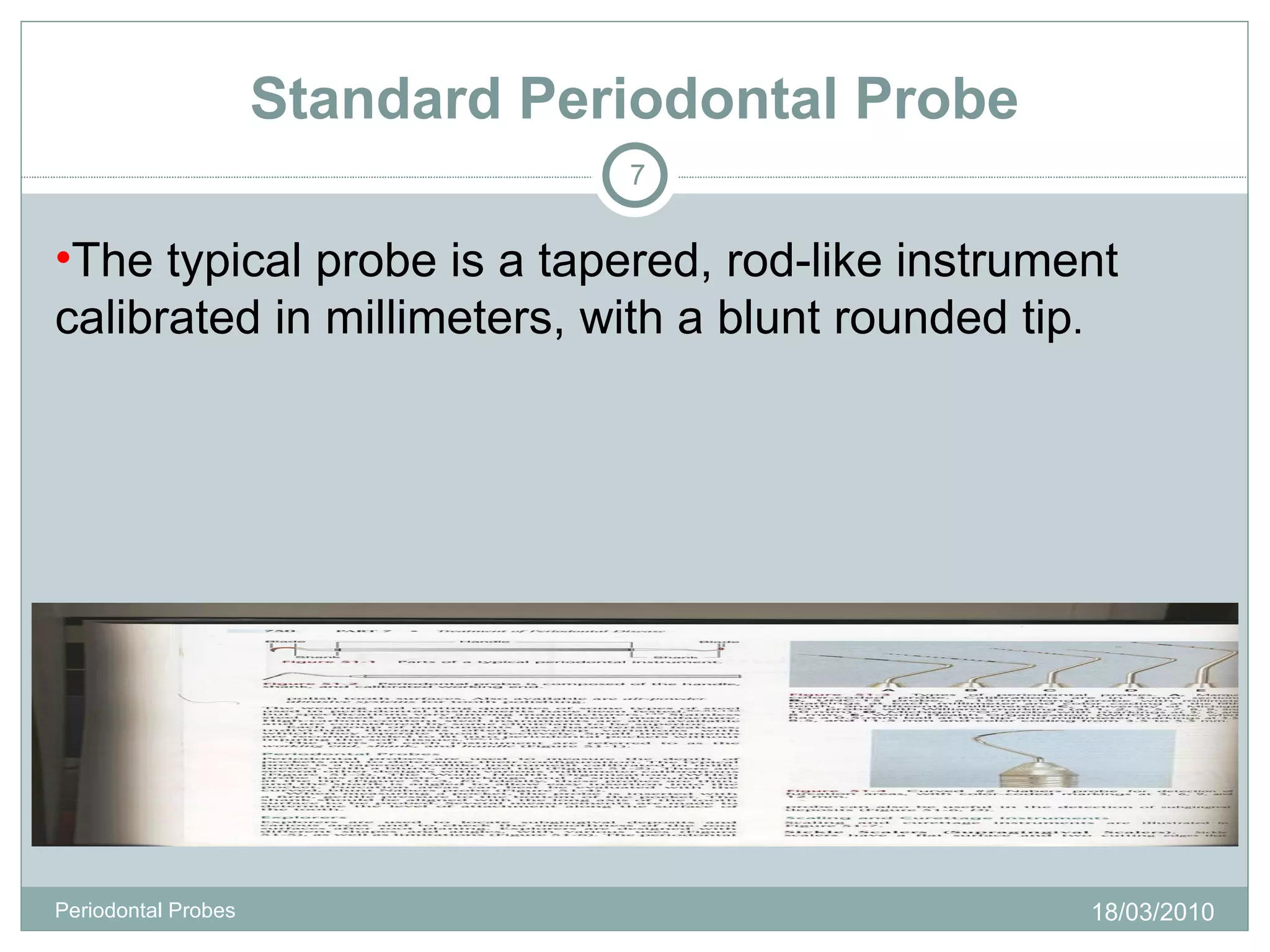 Periodontal probes | PPT