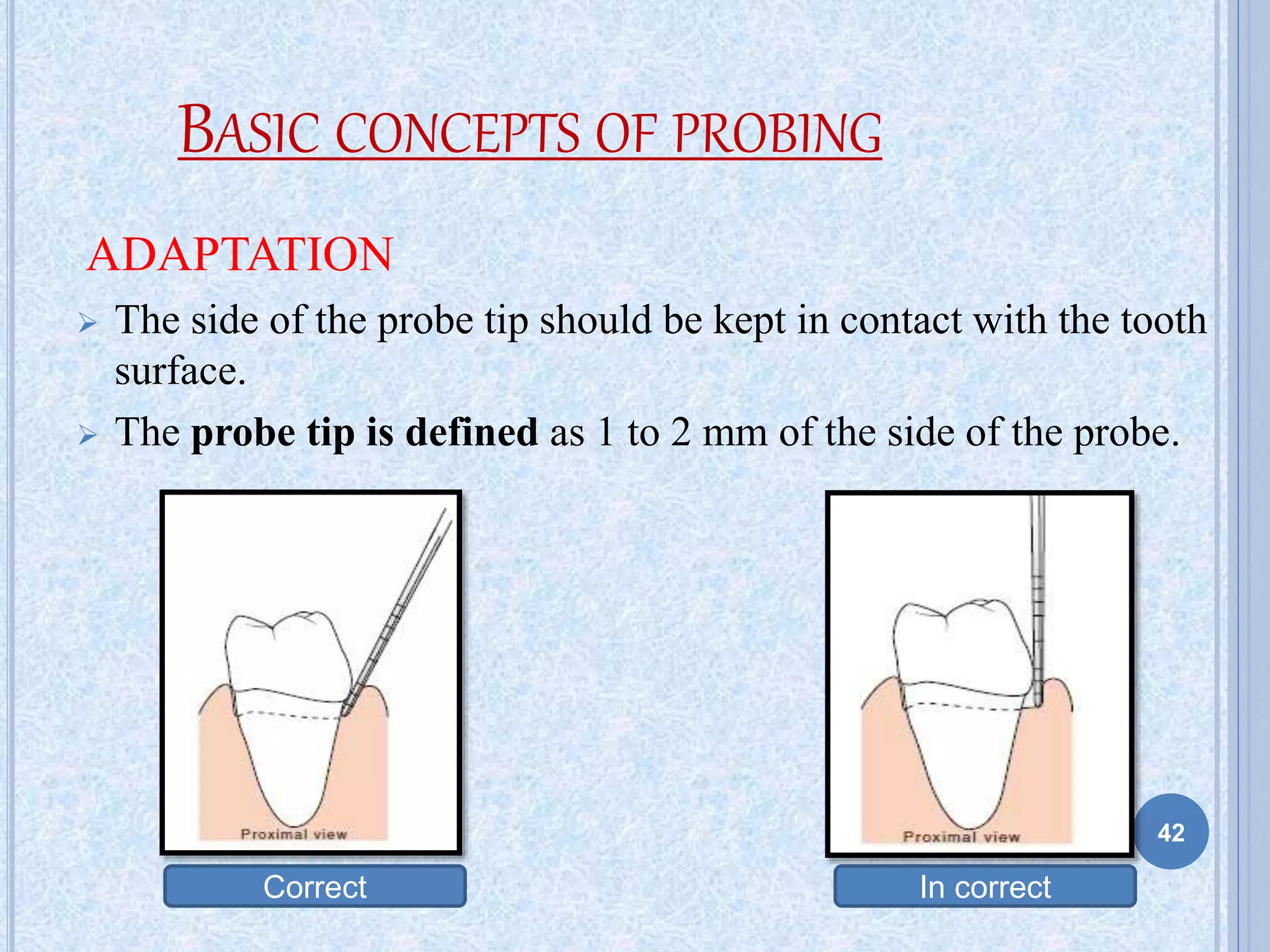 Periodontal probes | PPTX