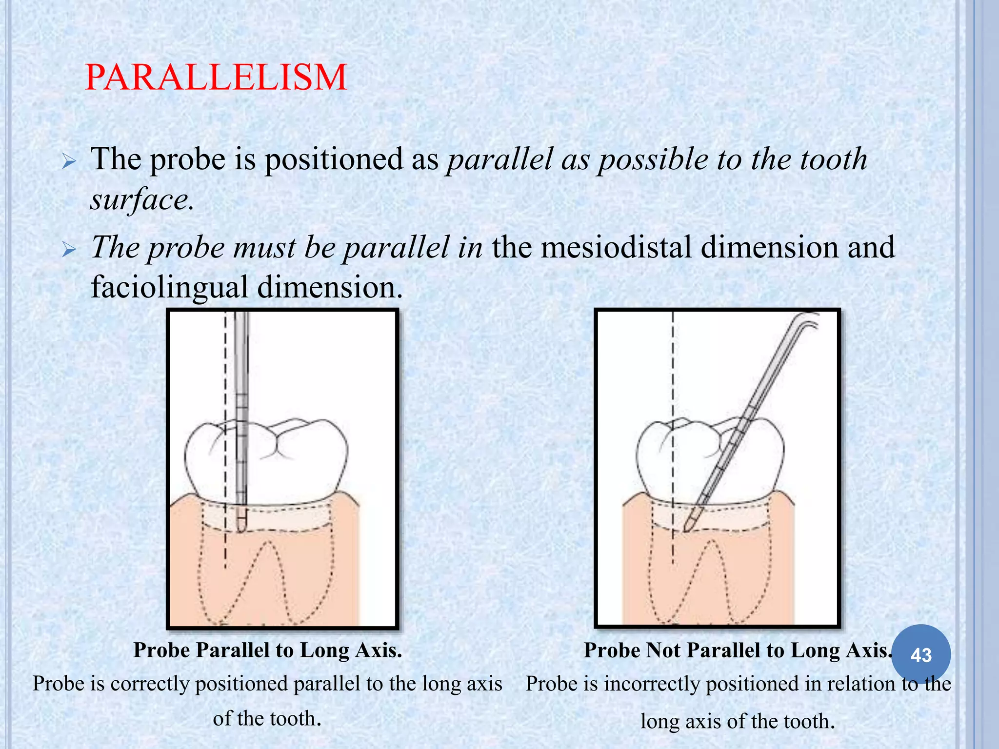 Periodontal probes | PPTX