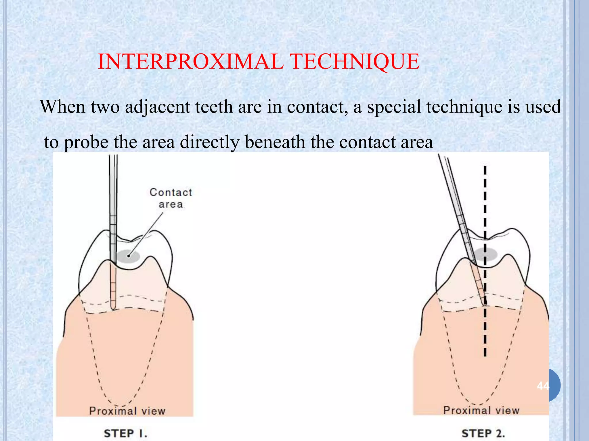 Periodontal probes | PPTX
