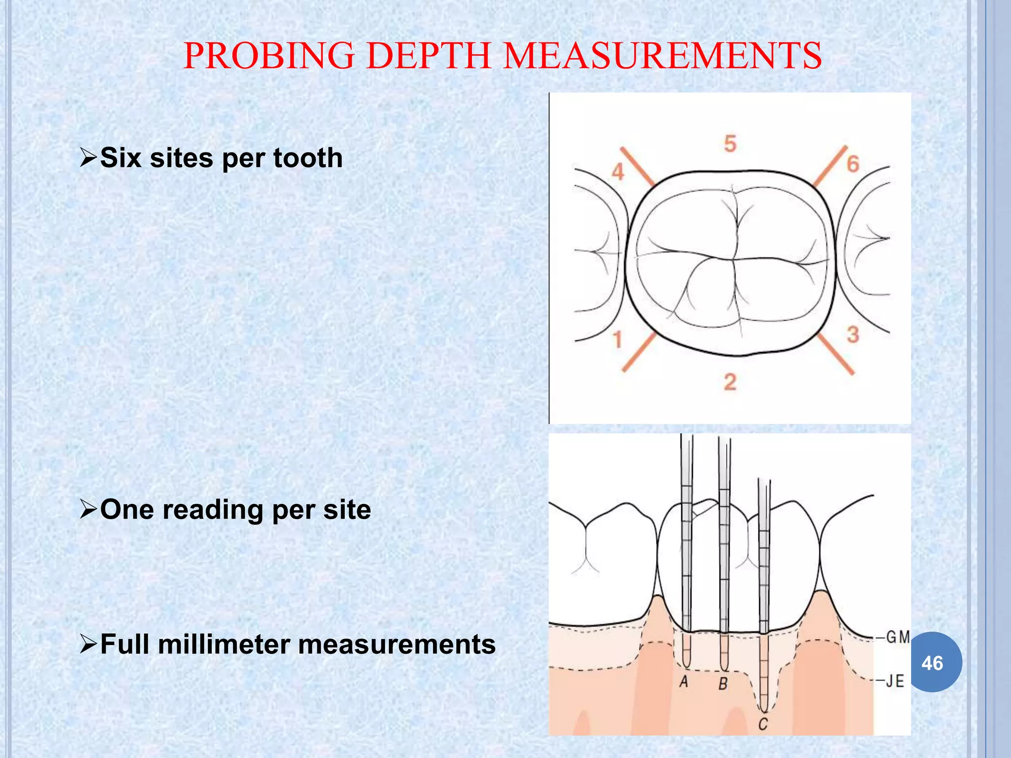 Periodontal probes | PPTX