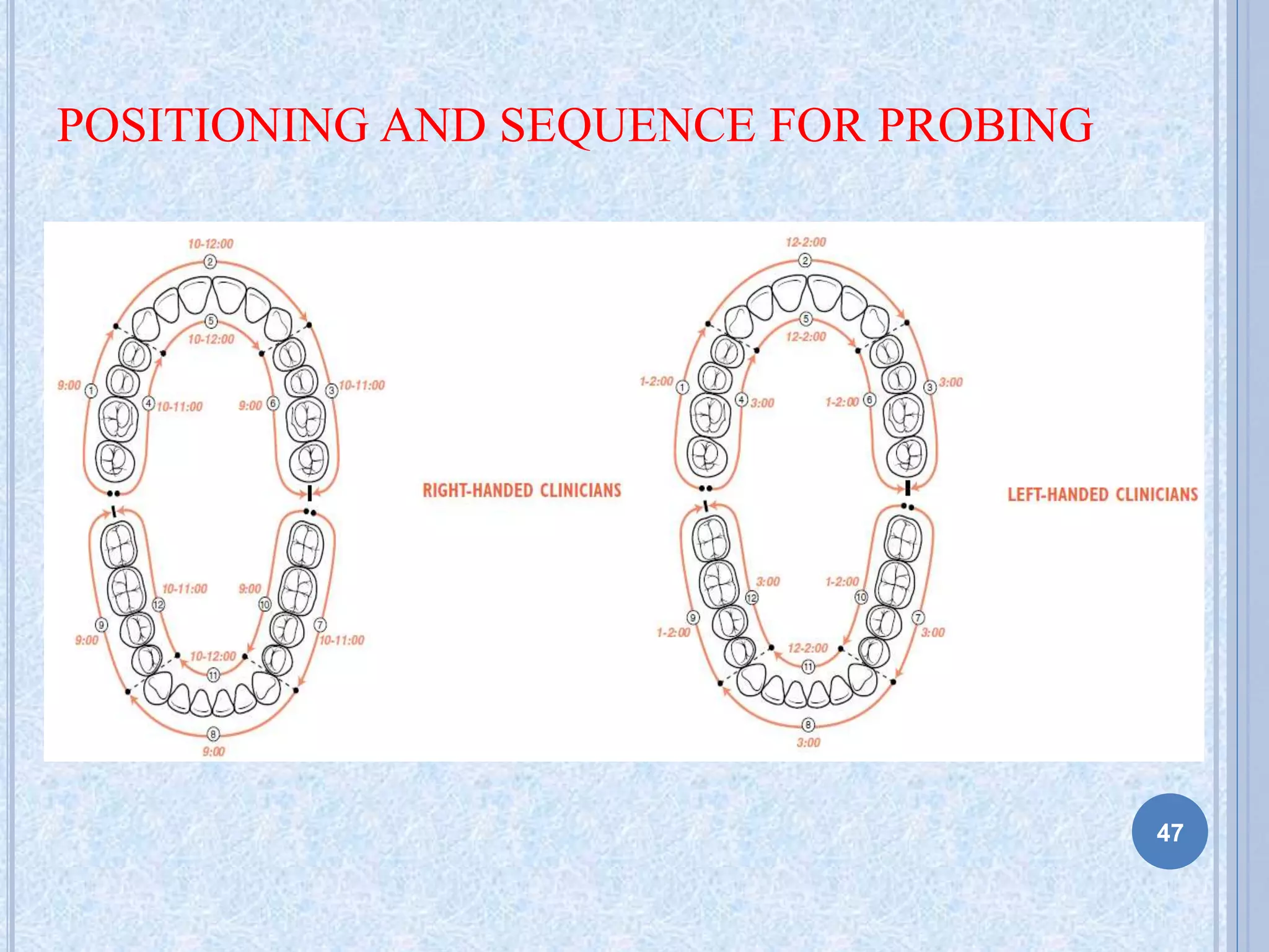 Periodontal probes | PPTX