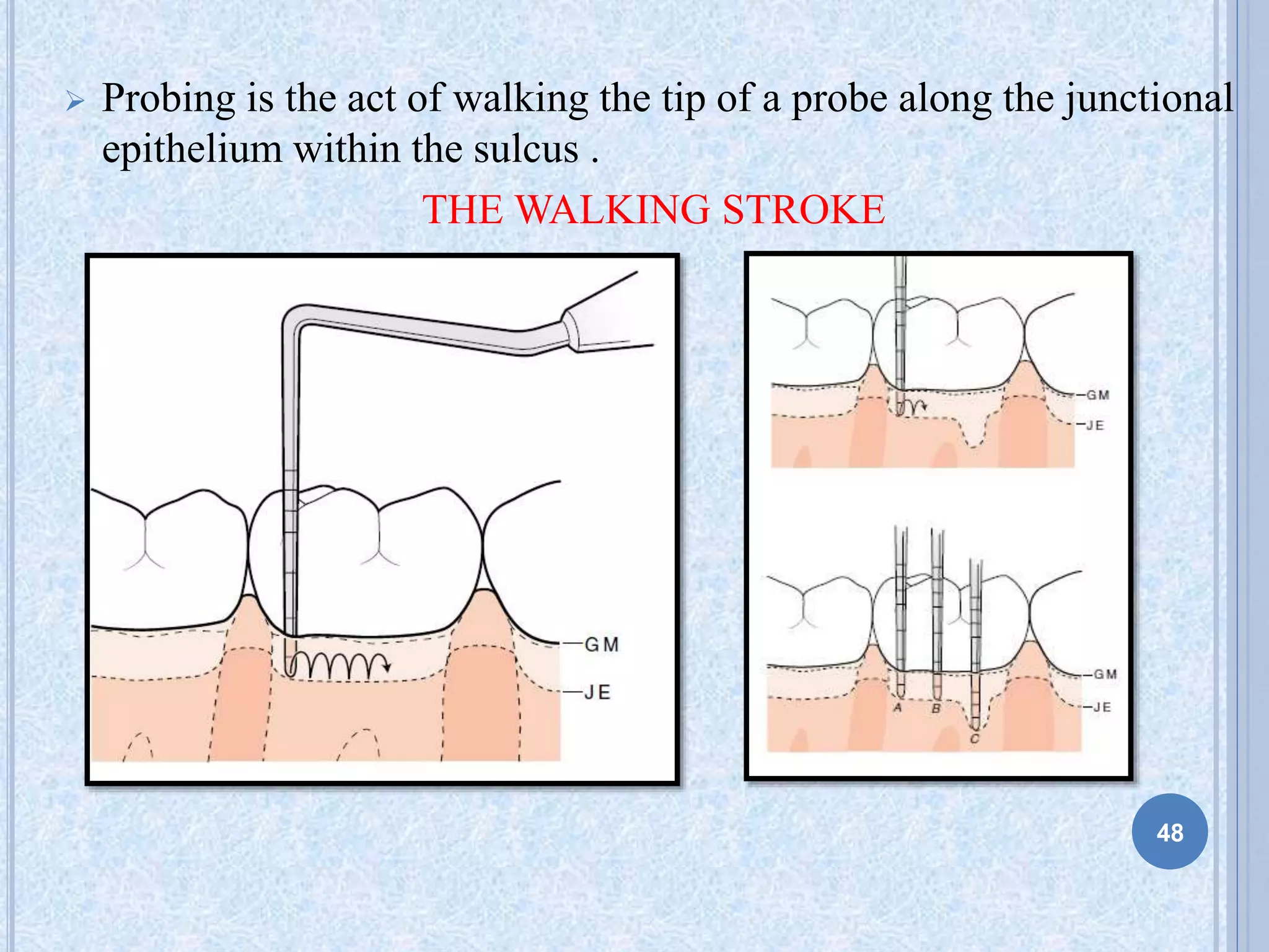 Periodontal probes | PPTX