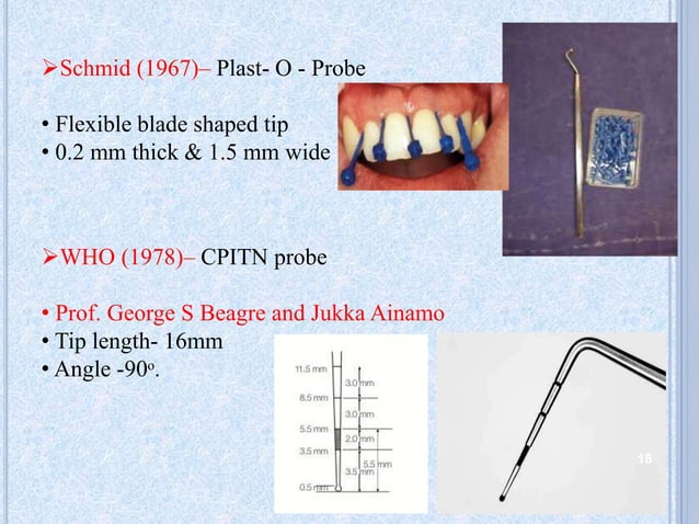 Periodontal probes | PPTX | Oral care | Personal Care