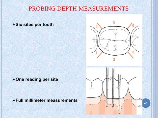 Periodontal probes | PPTX | Oral care | Personal Care