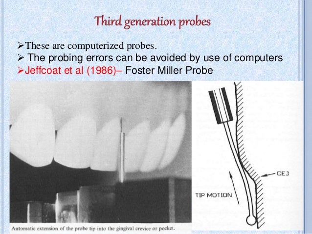 Periodontal probes