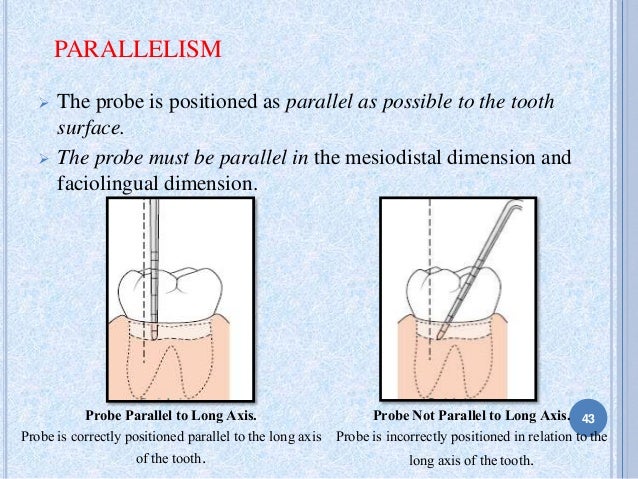 Periodontal probes