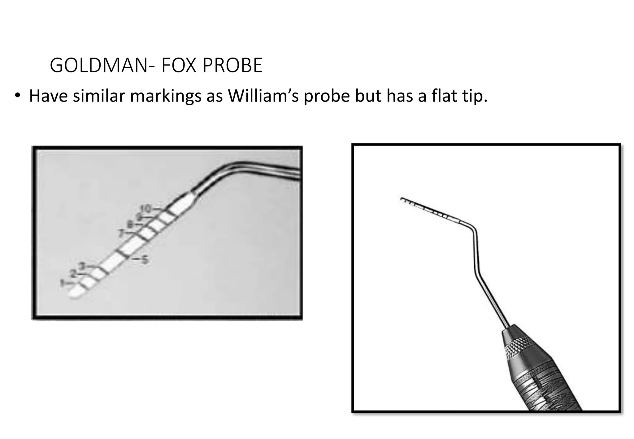 Periodontal probes | PPTX