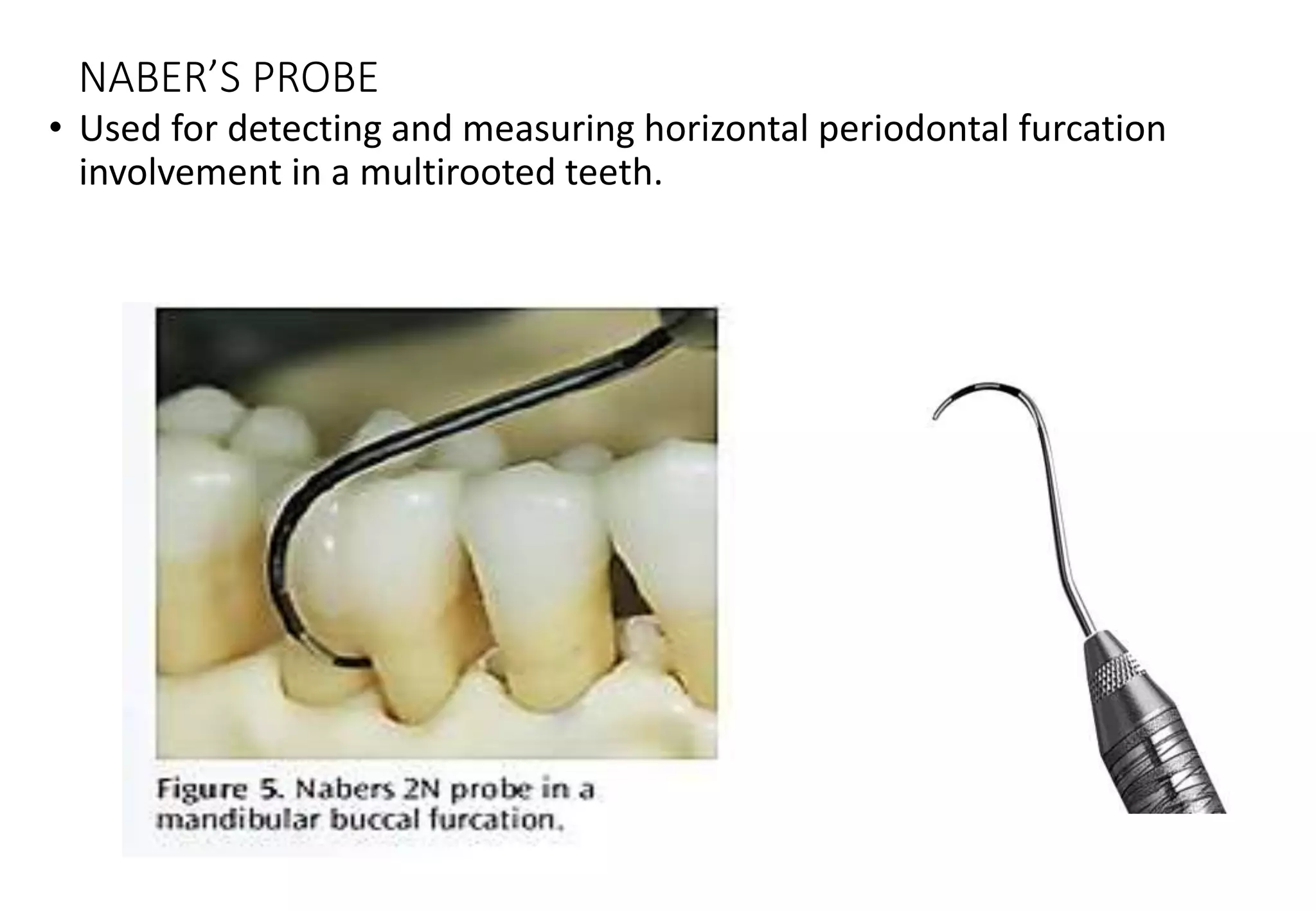 Periodontal probes | PPTX