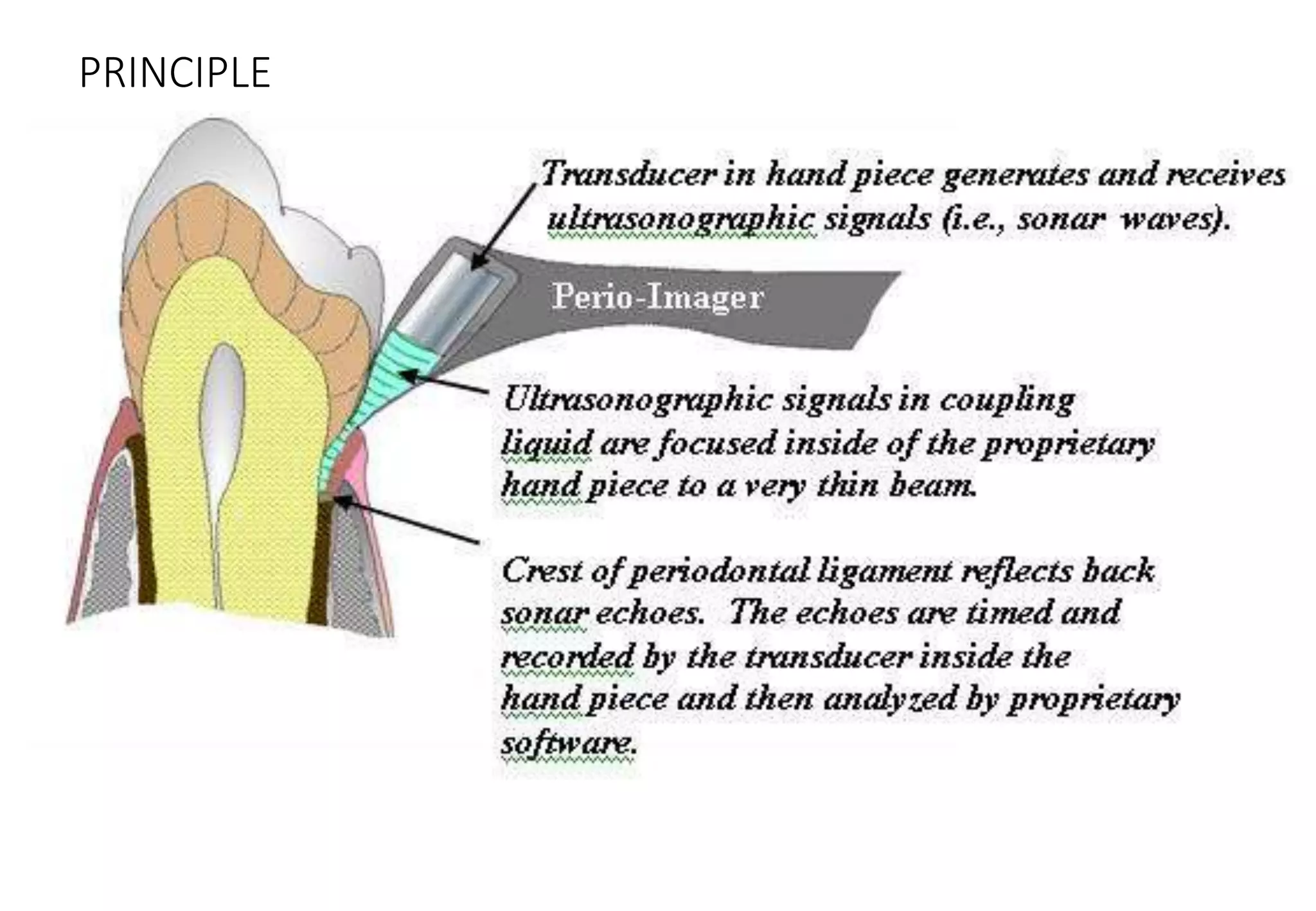 Periodontal probes | PPTX | Oral care | Personal Care