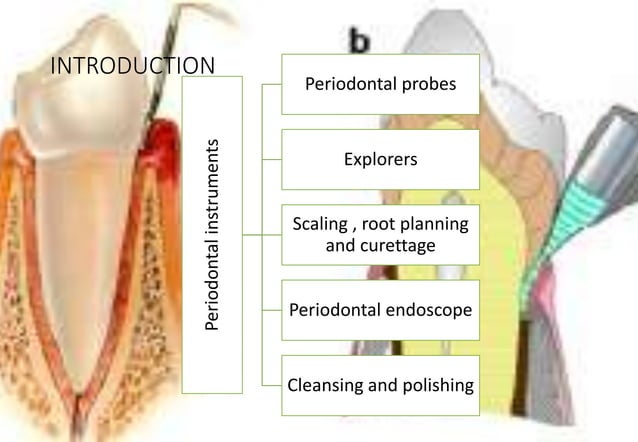Periodontal probes | PPTX | Oral care | Personal Care