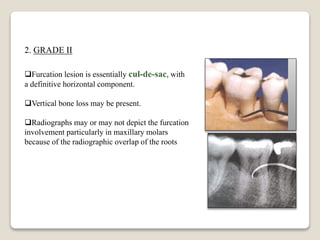 Periodontal probing | PPTX | Dental Health | Diseases and Conditions