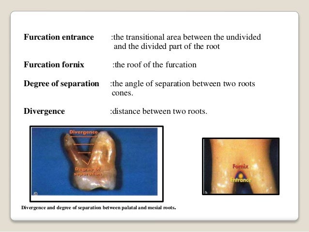 Periodontal probing