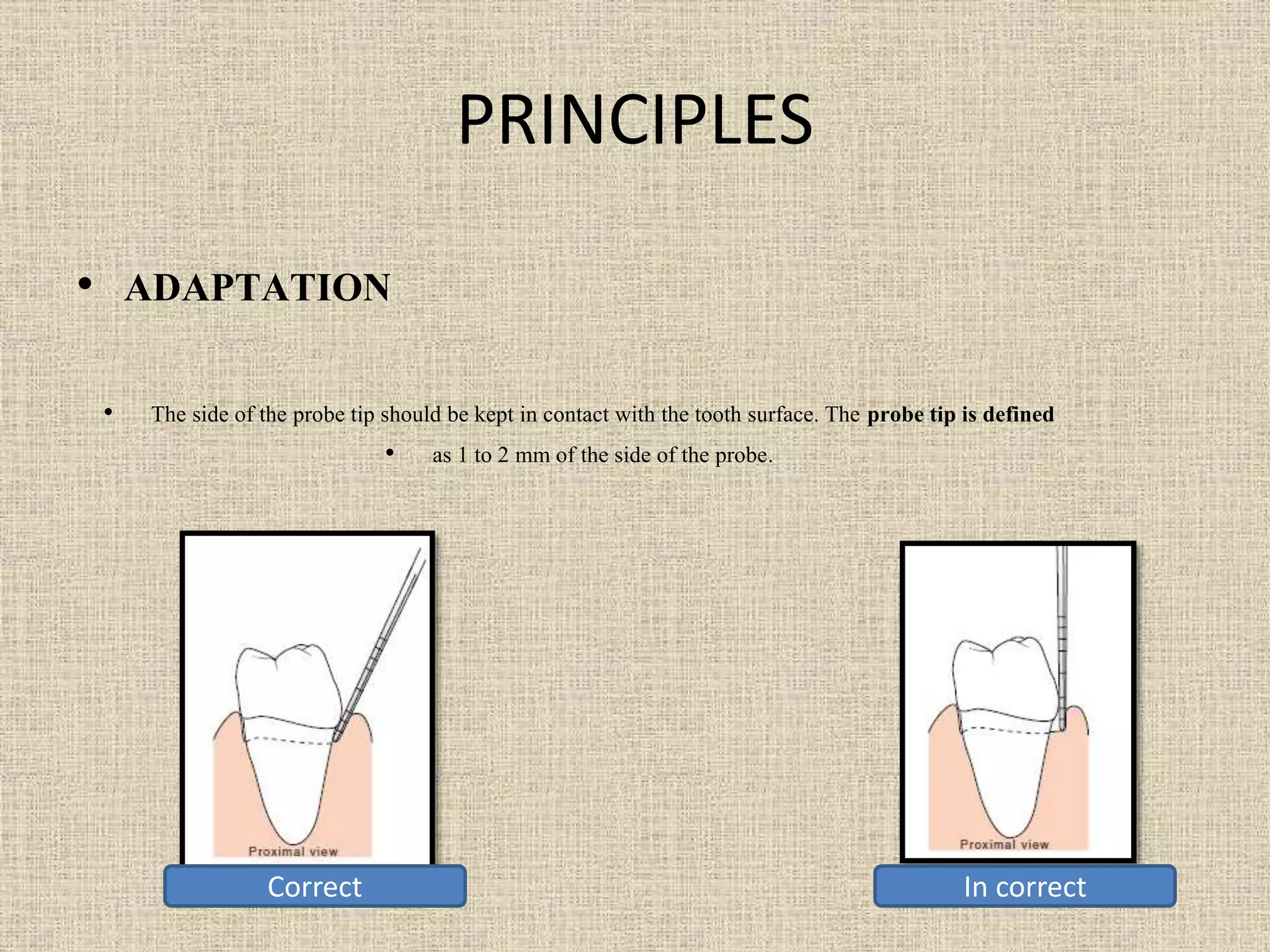 Periodontal probing and techniques | PPTX