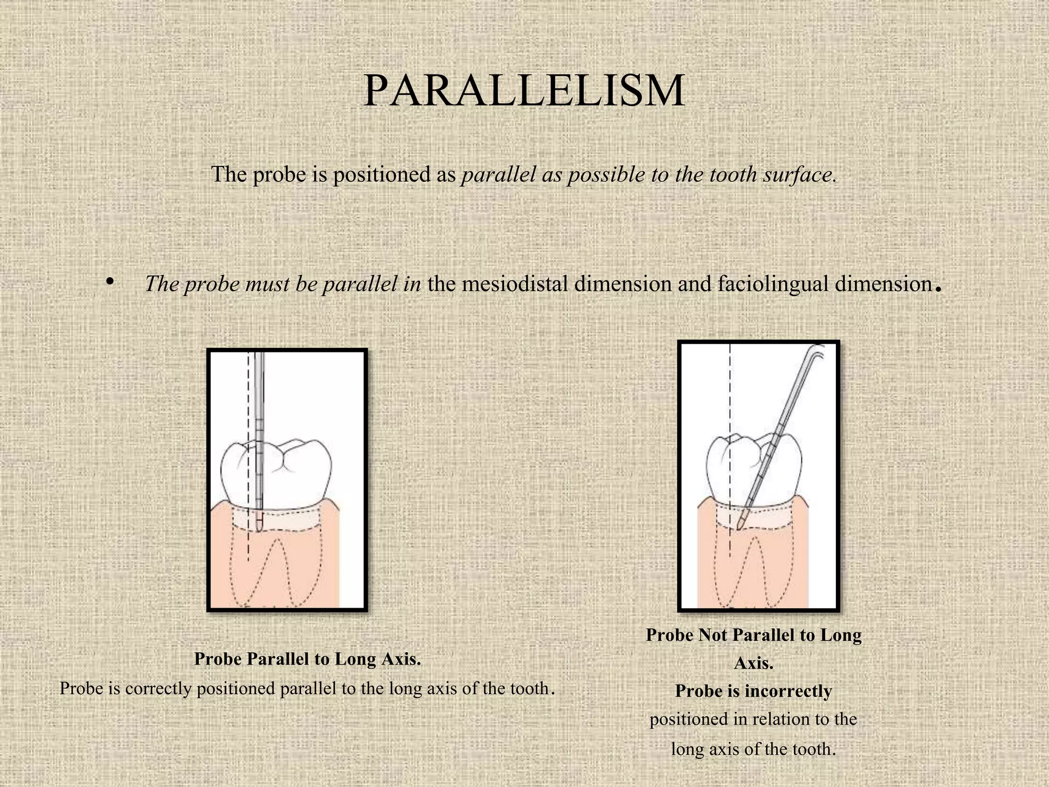 Periodontal probing and techniques | PPTX