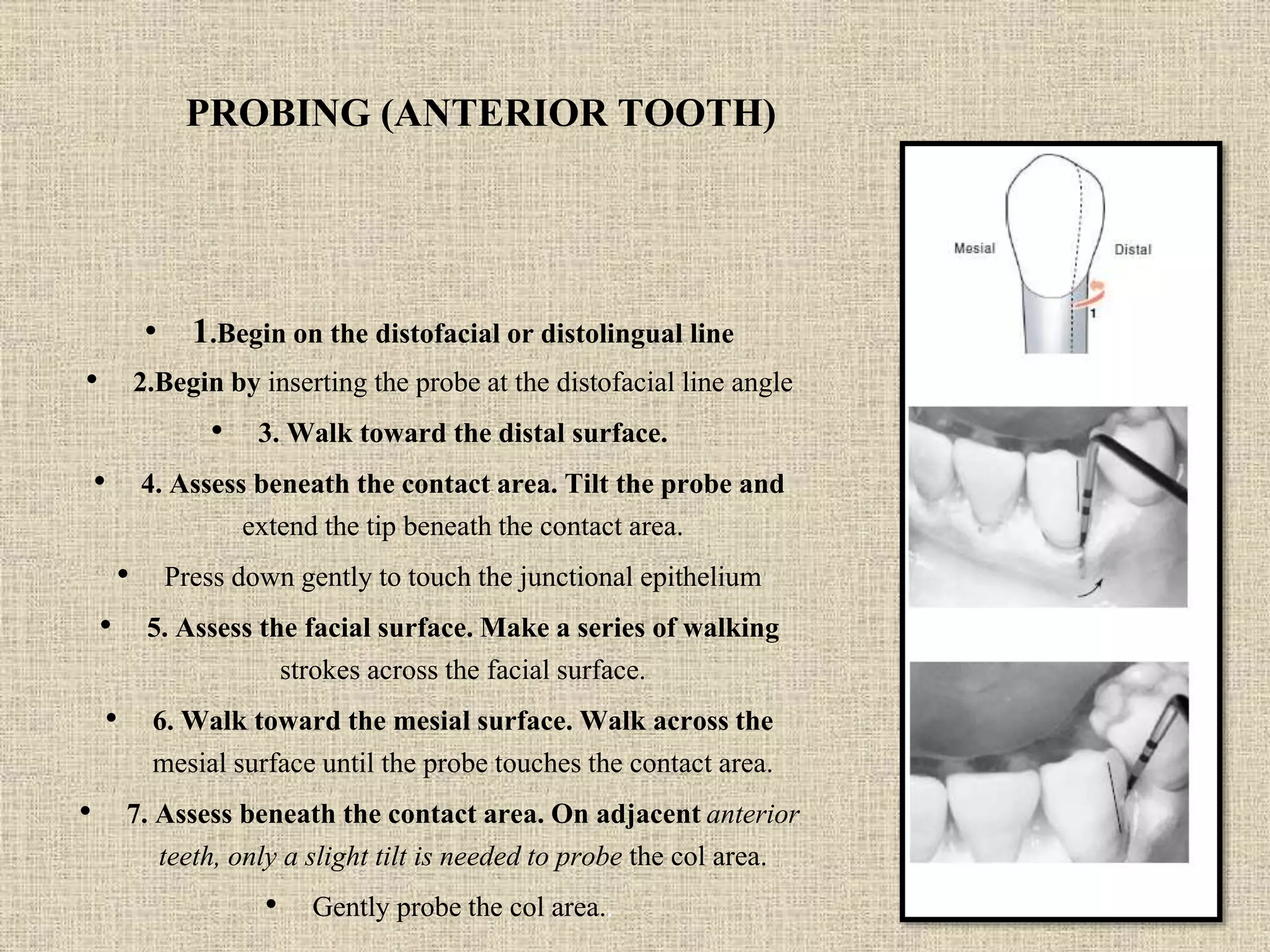 Periodontal probing and techniques | PPTX