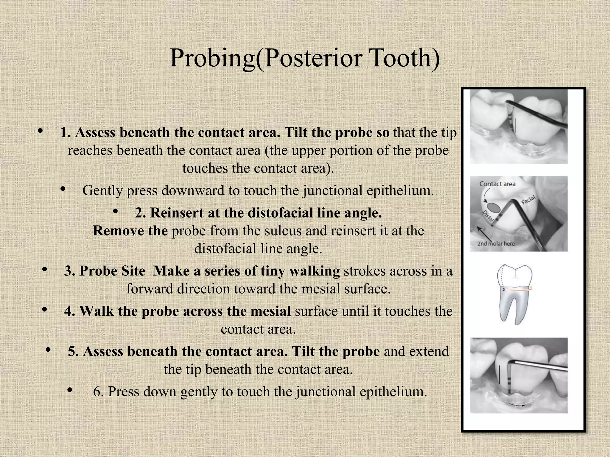 Periodontal probing and techniques | PPTX