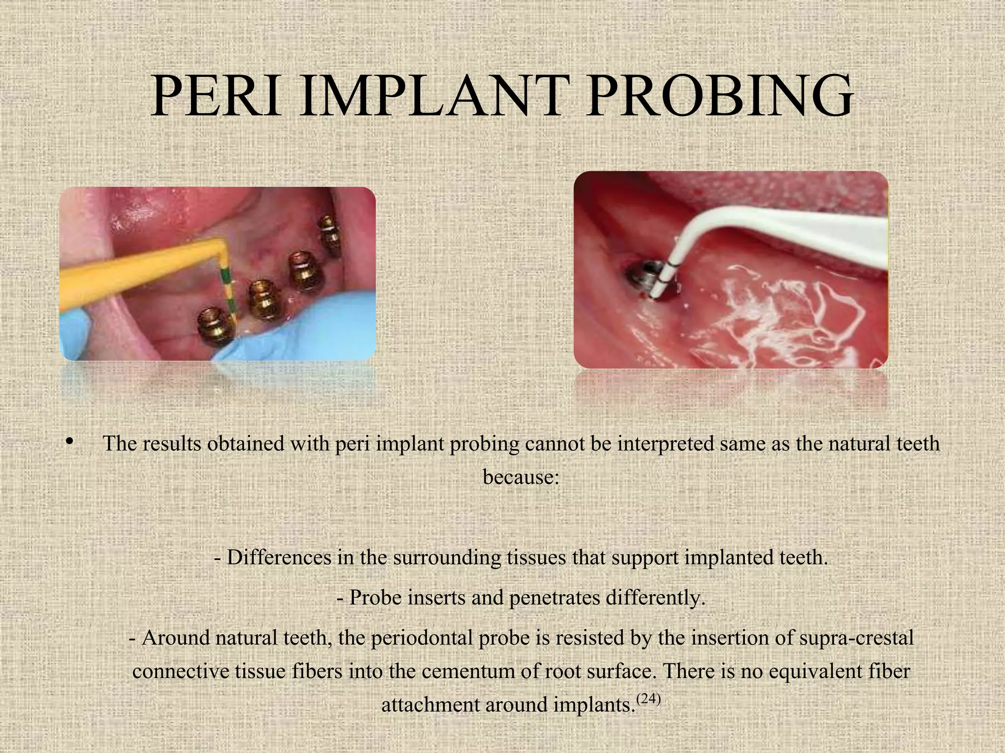 Periodontal probing and techniques | PPT
