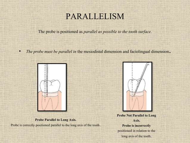 Periodontal probing and techniques | PPTX