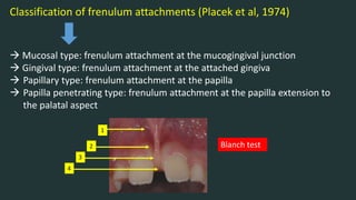 periodontal problem at the specific area.pptx