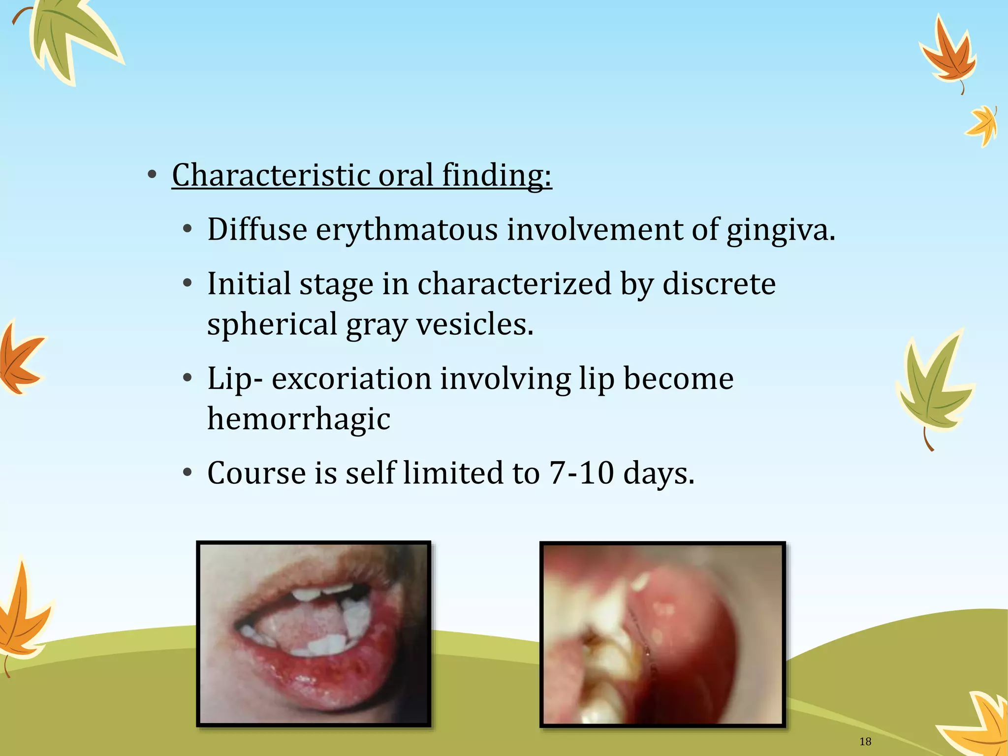 gingiva and periodontal problems in children | PPTX