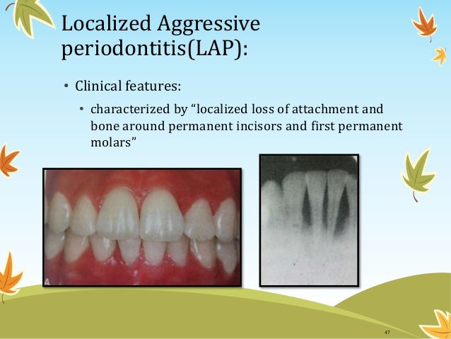 gingiva and periodontal problems in children