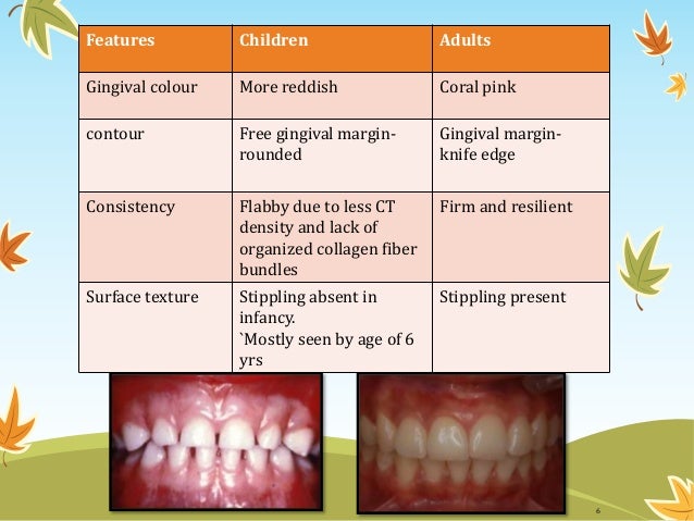 gingiva and periodontal problems in children