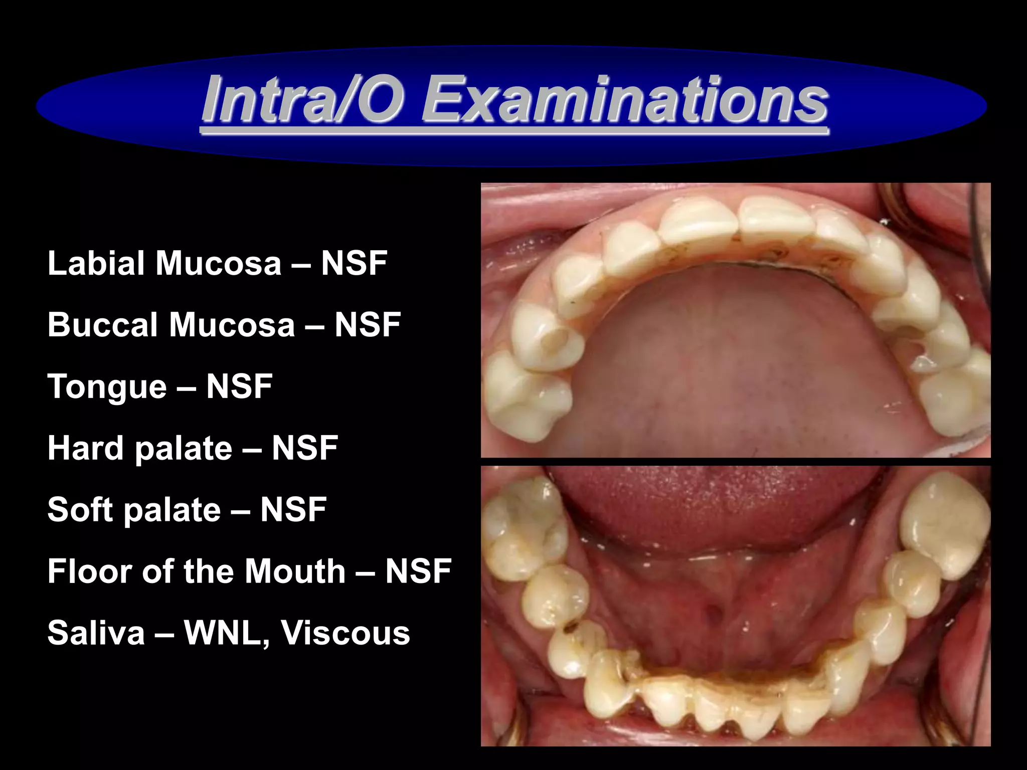 Periodontal prognosis and prosthetic treatment planing | PPTX
