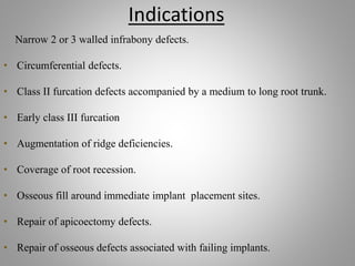 Periodontal regeneration | PPTX