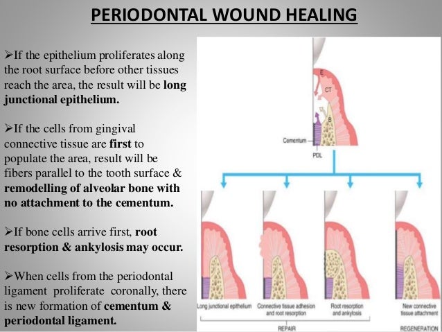 Periodontal regeneration