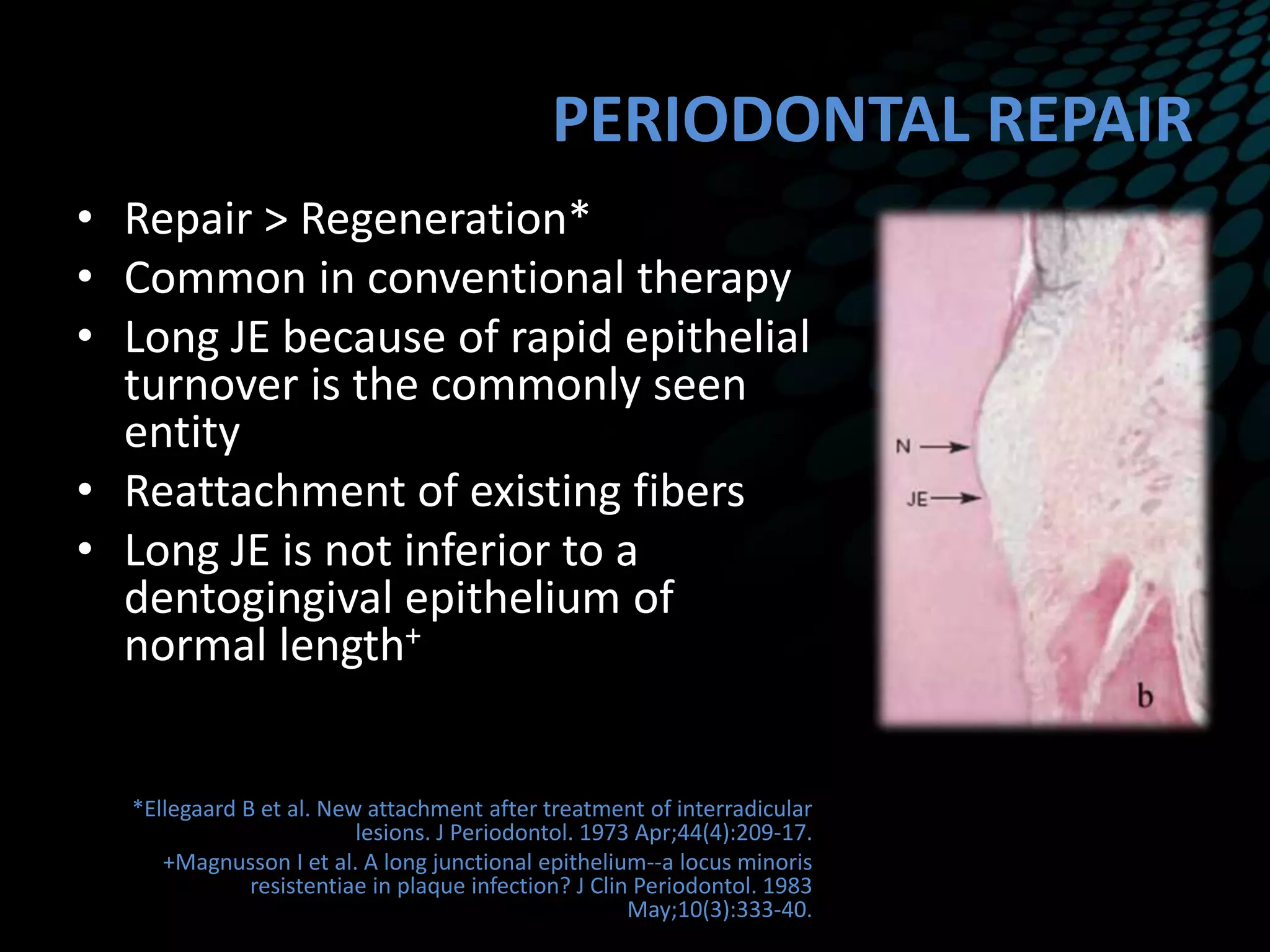 Periodontal regeneration | PPT