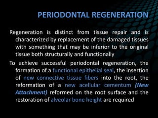 Periodontal regeneration | PPTX