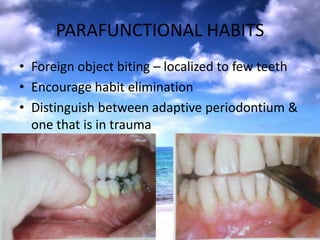 Periodontal response to external forces | PPTX