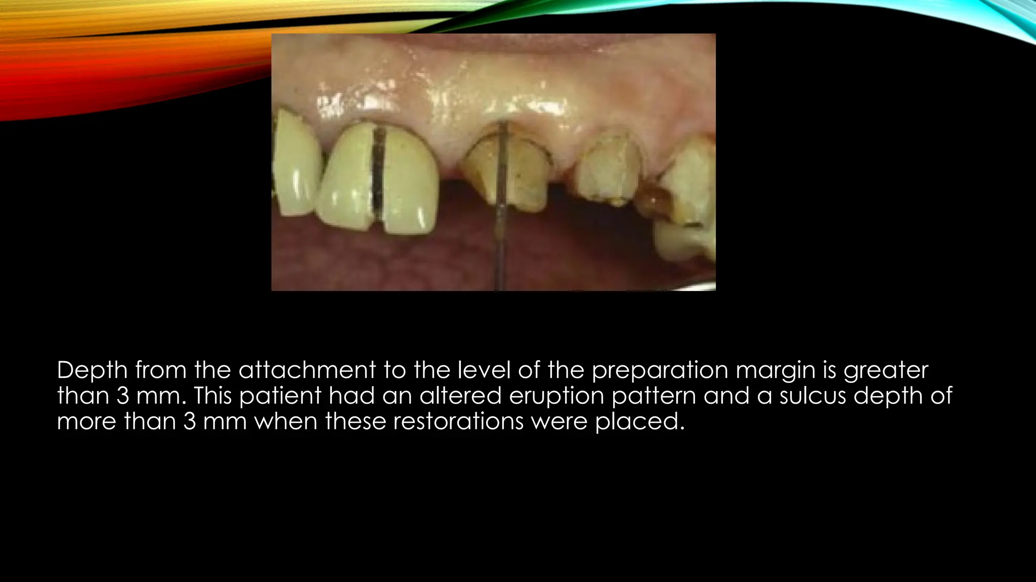 periodontal restorative inter relationship.pptx