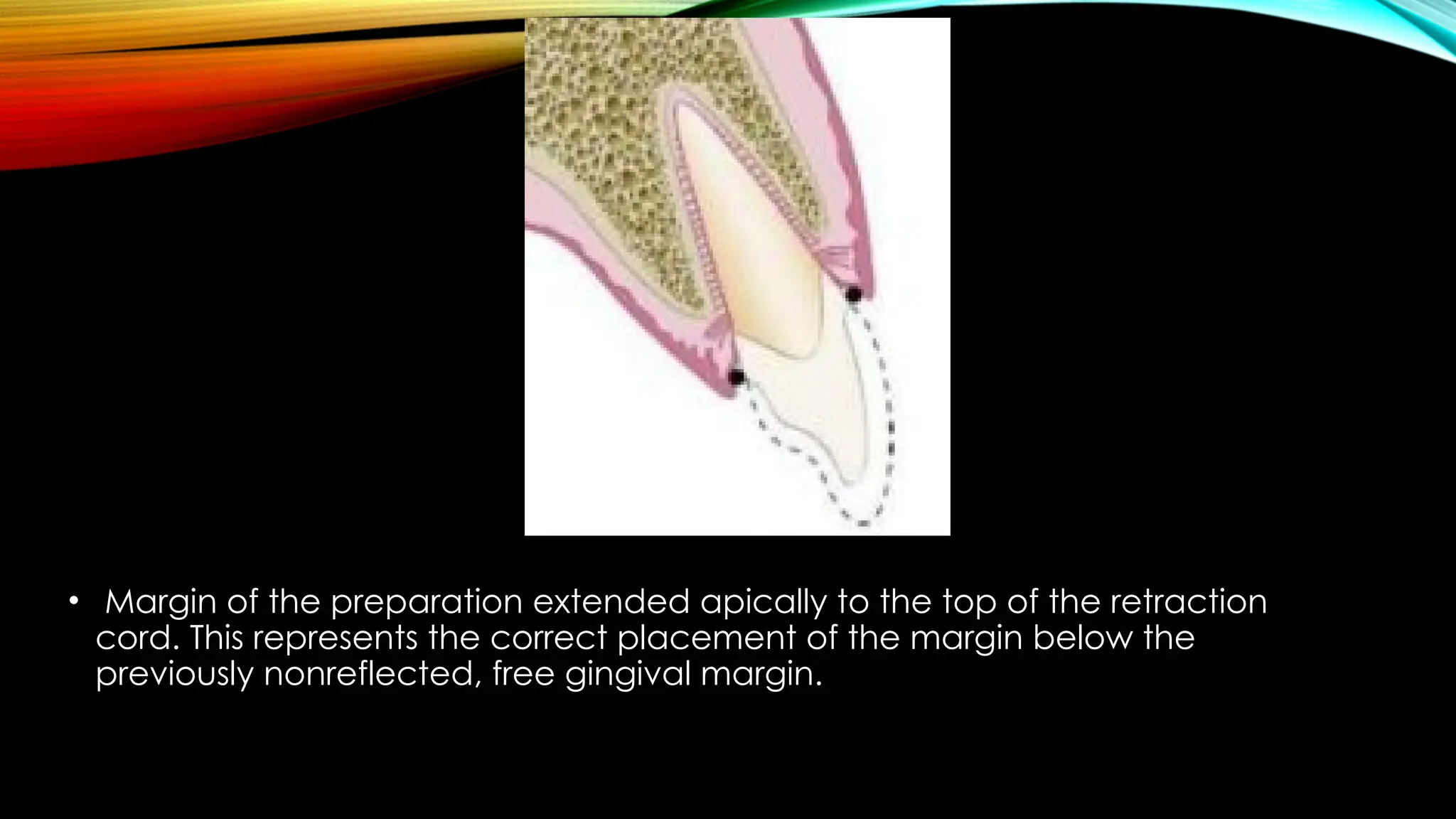 periodontal restorative inter relationship.pptx