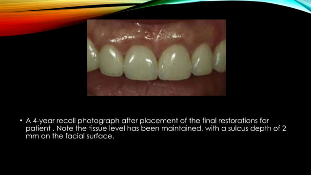 periodontal restorative inter relationship.pptx