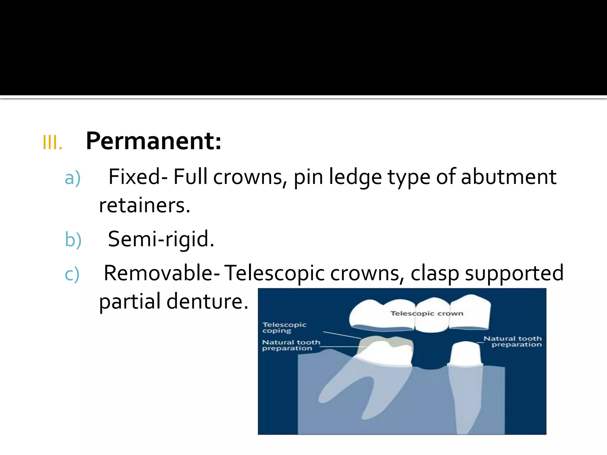 Periodontal splinting | PPTX