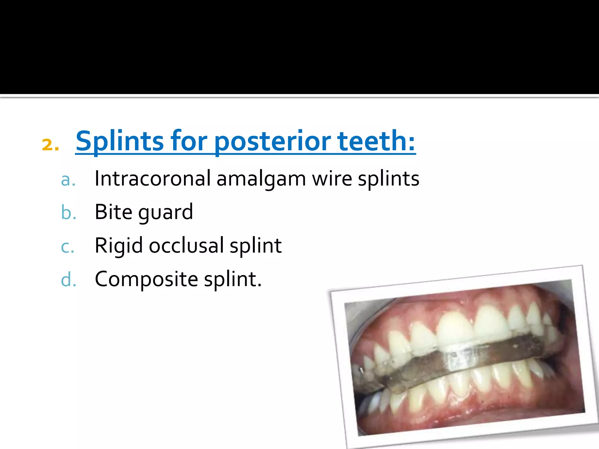 Periodontal splinting | PPTX