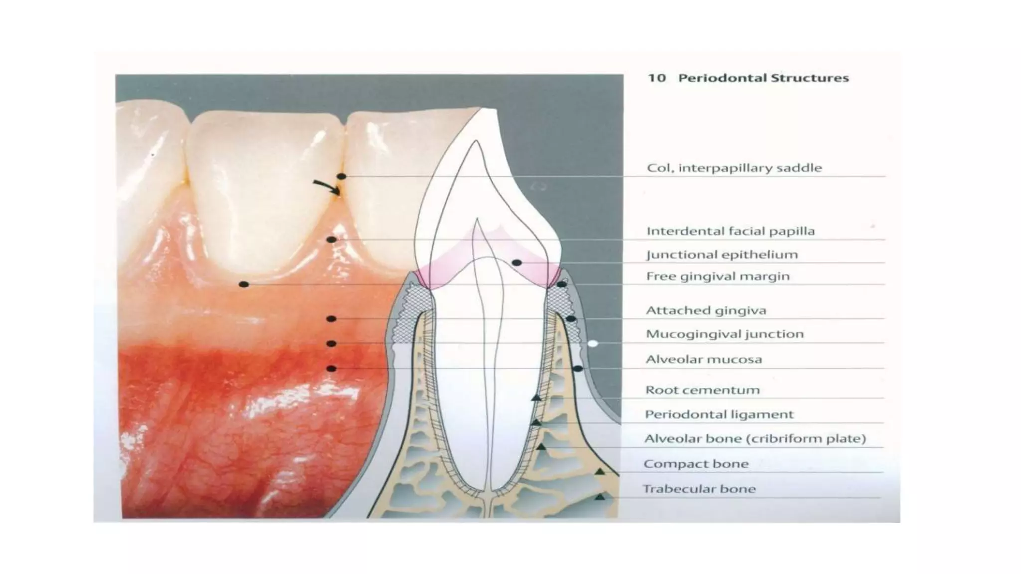 Periodontal surgery | PPTX