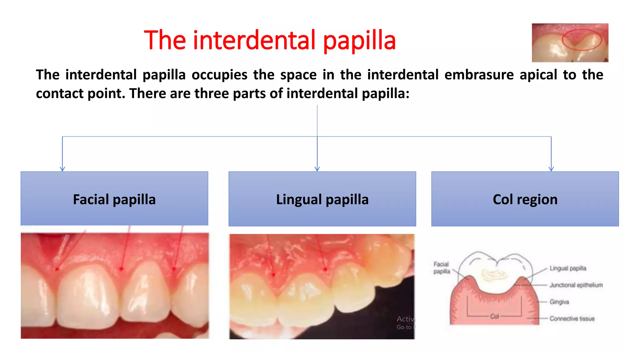 Periodontal surgery | PPTX