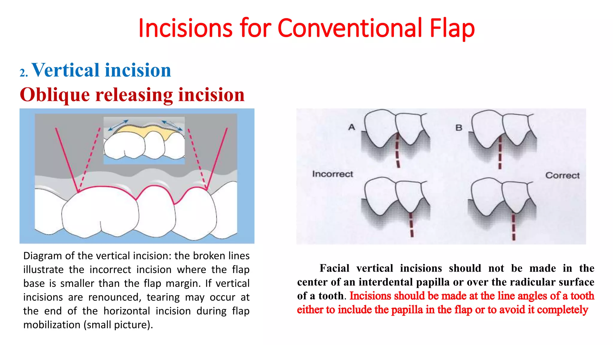Periodontal surgery | PPTX
